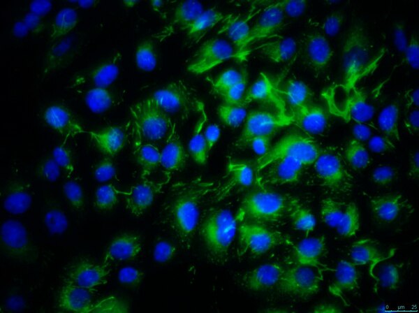 PyMT-1099 Mouse Mammary Tumor EMT Model Cell Line | SCC422